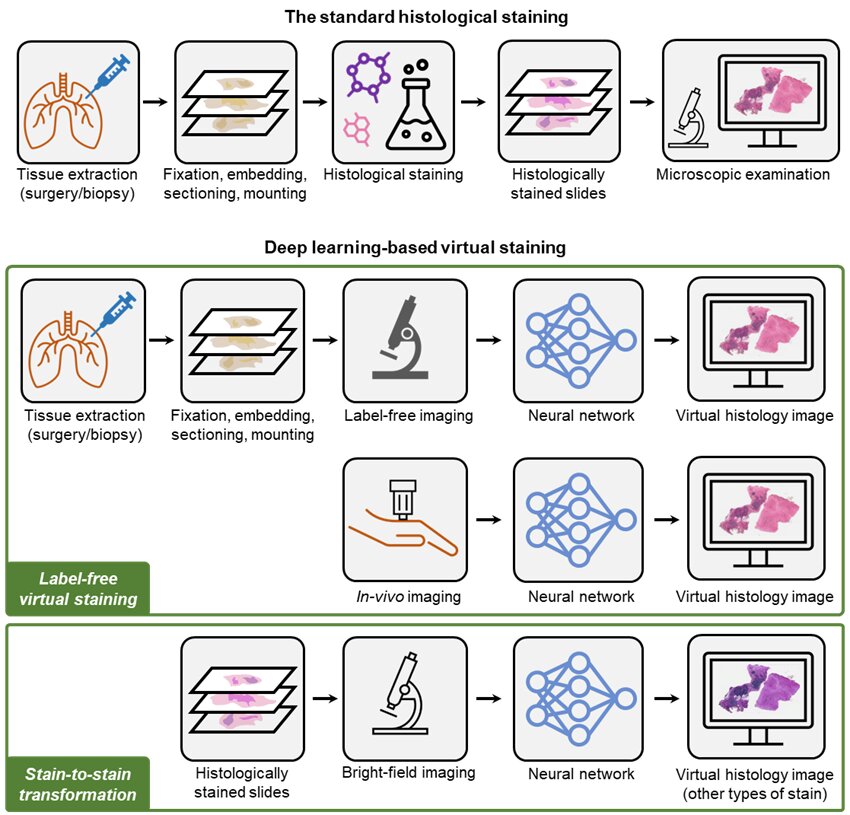 Study shows that distinct pyramidal cell types drive different patterns ...