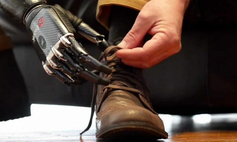 Did You Know AI is about to Restore the Sixth Sense in Bionic Limbs ...