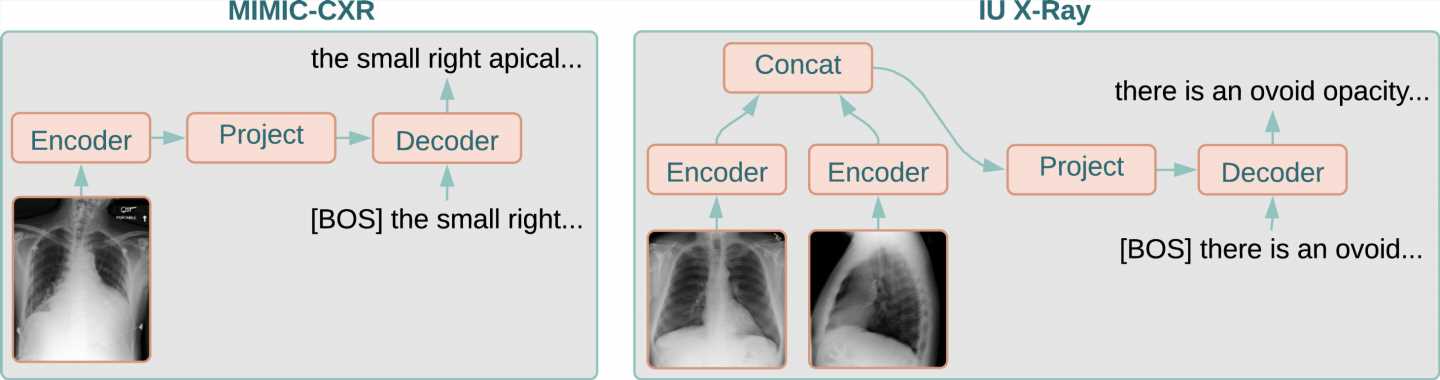 Study identifies method for improving AI diagnoses of chest X-rays ...